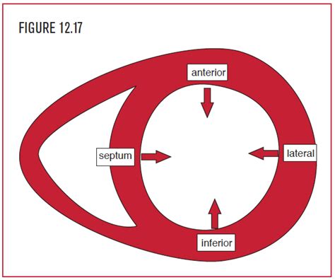 12 Left Bundle Branch Block Medicine Digital Learning
