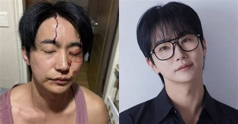 [전문] 전호준 前여친 폭행 성병 의혹 입 열었다…정당방위 무단침입 제지하느라