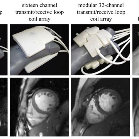 Synopsis Of RF Coil Configurations Used In This Study Top Photographs Download Scientific