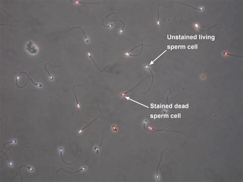 Biology Microscope Sperm At Harry Leslie Blog
