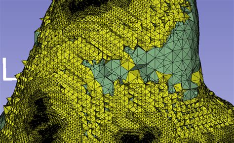 Meshing Self Intersecting Faces Support 3d Slicer Community
