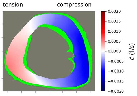 8 Spatial Distribution Of The Strain Induced By The In Vivo Loading