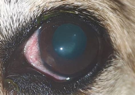 Non‐healing Corneal Ulcer Secondary To Reopened Conjunctival Incision