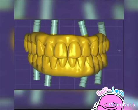 Exoca D1 On Linkedin All On X