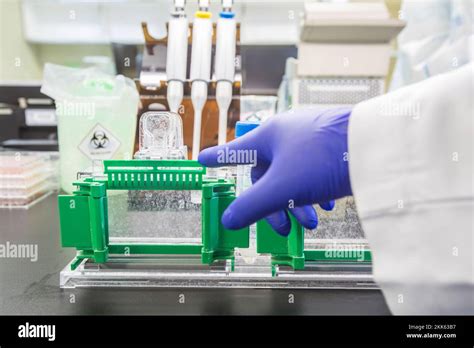Western Blot Analysis Use As Protein Analysis For Protein Detection