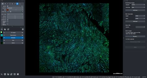 Cosmx® Analysis Scratch Space Blog Cosmx® Analysis Scratch Space Blog