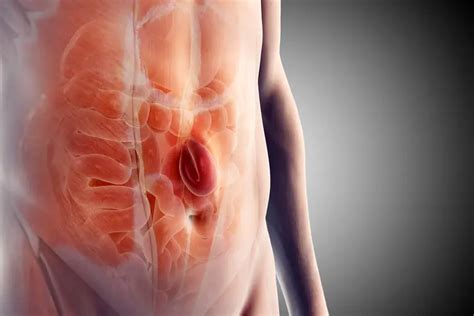 Hernia Types Causes Symptoms And Treatment