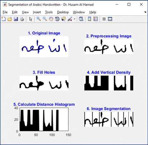 A Sample Results Of The Proposed Segmentation Technique Download