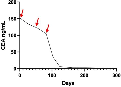 Symptomatic Pseudoprogression In Metastatic Colorectal Cancer Bmj