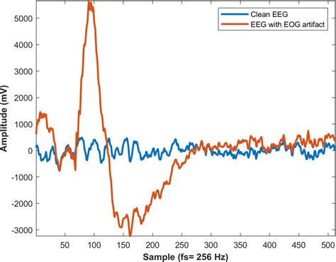 An Example Of Ground Truth Eeg Segment And The Download Scientific