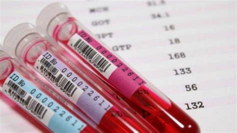 Eritrosit Nedir Yüksekliği Ve Düşüklüğü Ne Anlama Gelmektedir Değerleri Kaç Olmalıdır Onedio