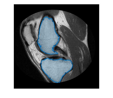 use freehand rois to refine segmentation masks matlab and simulink
