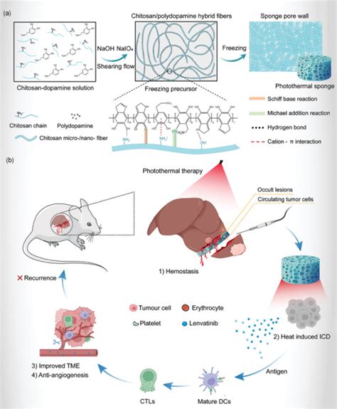 Photothermal Fibrous Chitosanpolydopamine Sponge For Intraoperative Hemostasis And Prevention