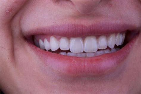 Abdulnaser Dico On Linkedin Lets Do It Naturally