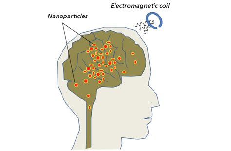 The Remote Controlled Brain Discover Magazine