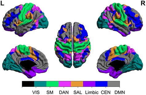 Frontiers Large Scale Brain Networks And Intra Axial Tumor Surgery A