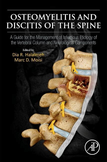 Osteomyelitis And Discitis Of The Spine A Guide For The Management Of