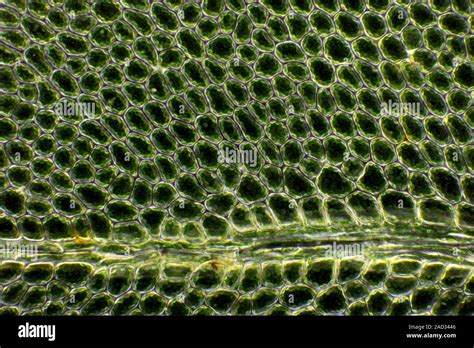 Moss Leaf Darkfield Illuminated Light Micrograph Of A Section Through A Leaf From A Moss