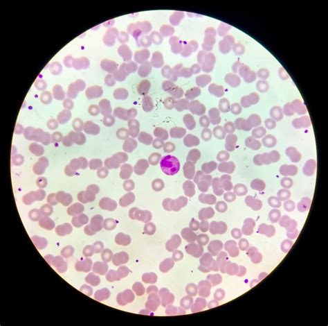 Granulocytes Types Describe Any Two Types Of Granulocytes Wbc W R T
