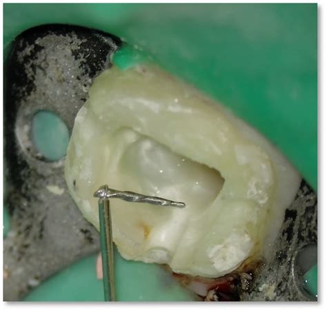 Dr Benjamin Boublil Planb Dental