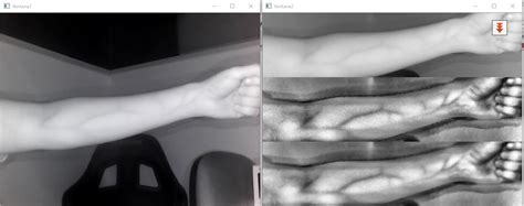 Background Subtraction For Vein Detection Opencv Qanda Forum