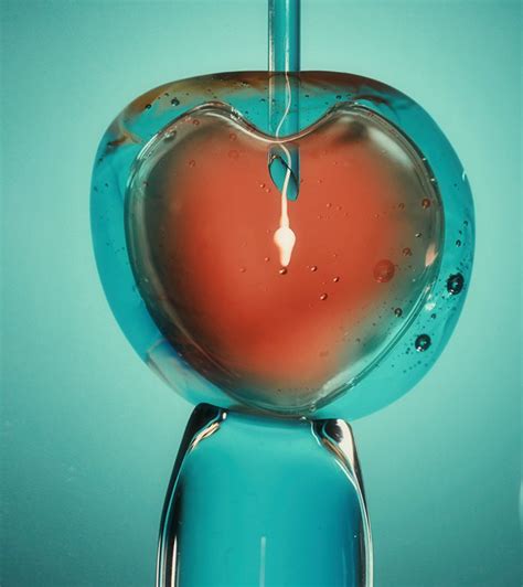 Male And Female Infertility Workup Nandi Ivf Expert Diagnostics