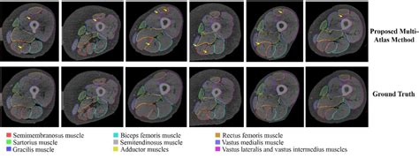 Figure 2 From Thigh Muscle Segmentation Using A Hybrid Frfcm Based