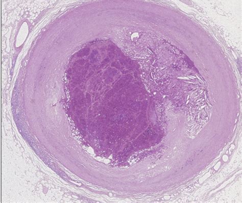 General Pathology Flashcards Quizlet