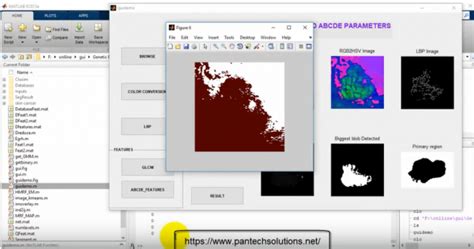 Skin Disease Detection Using Matlab