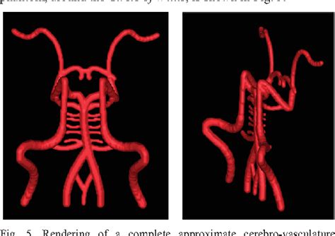 Figure 5 From Synthetic Reconstruction Of Human Carotid Vasculature Using A 2 D3 D Interface