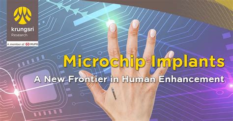 Microchip Implants A New Frontier In Human Enhancement