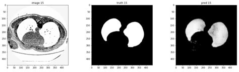 GitHub K Aniket Medical Images Segmentation