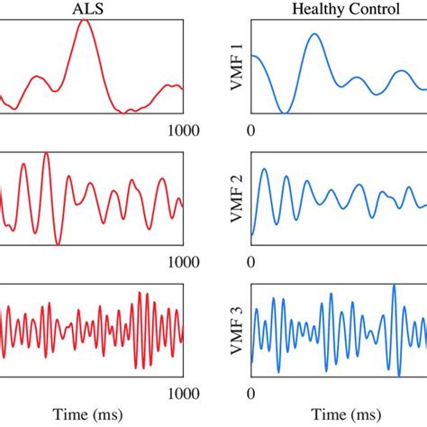 Healthy Control And Als Sample Erp Signal Of The Occipital Region Download Scientific Diagram
