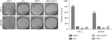 Cirs 7 Silencing Inhibited The Promotion Effect Mediated By Mir 7 Download Scientific Diagram