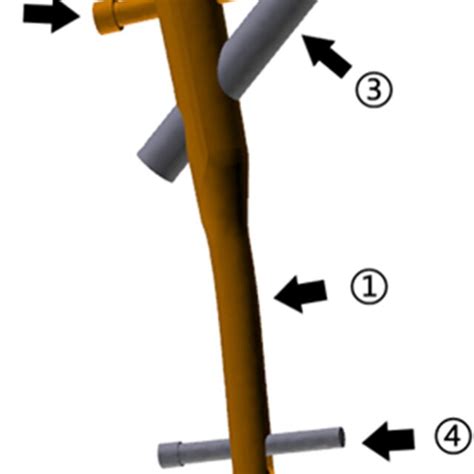 the three‐dimensional model of the new type of proximal femur bionic download scientific