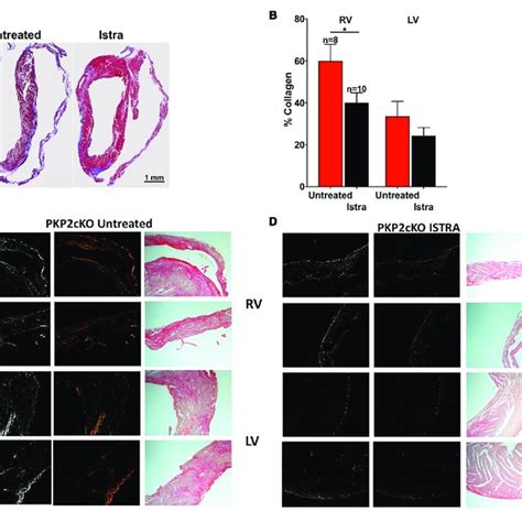 Pkp2 Mutation Above Versus Wide Type Bellow Download Scientific