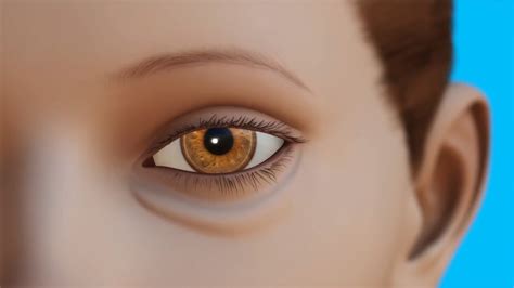 Dermatochalasis Symptoms Diagnosis And Management Aimu