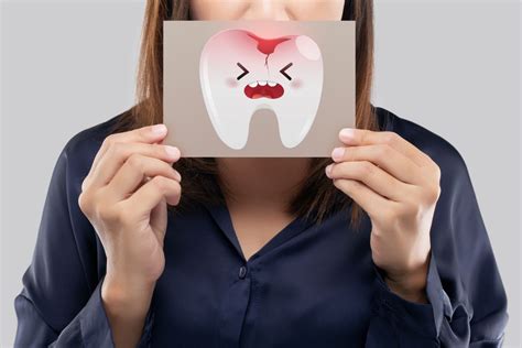 Por Qué Tratar Una Caries A Tiempo Clínica Dental Martinez Aviles