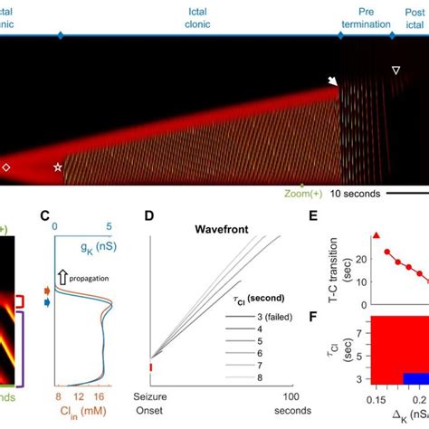 Stages Of Focal Seizure Evolution In A 1d Model A Spatiotemporal