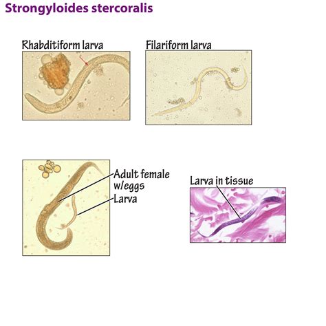 Strongyloides Stercoralis Life Cycle