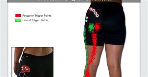 Joyce Cupits Blog Triggerpunkter