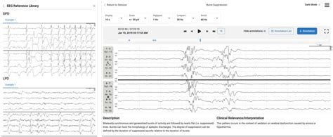 eeg portal ceribell