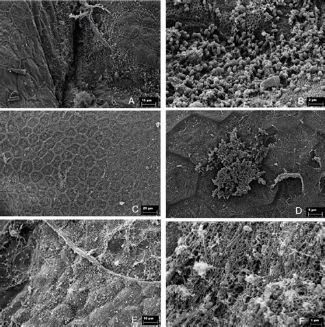 Scanning Electron Microscope Sem Pictures Of The Dorsal Skin Of Three Download Scientific