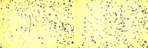 Image Detect Drops Of Water On A Card And Count The Amount And Its
