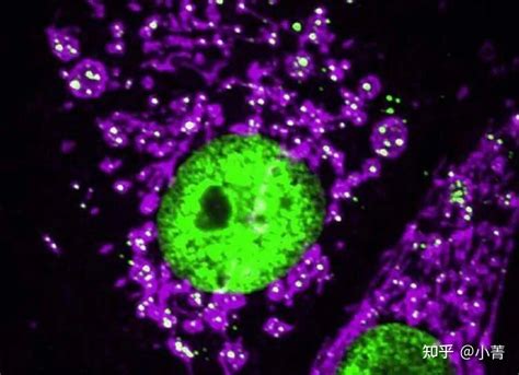 首次！同期2篇nature揭示线粒体代谢物与炎症之间的关联 知乎