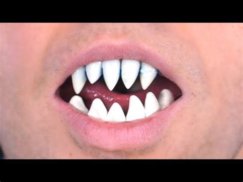 Human With Shark Teeth