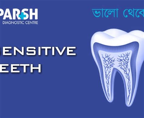 Bacterial Vaginosis Sparsh Diagnostic Center