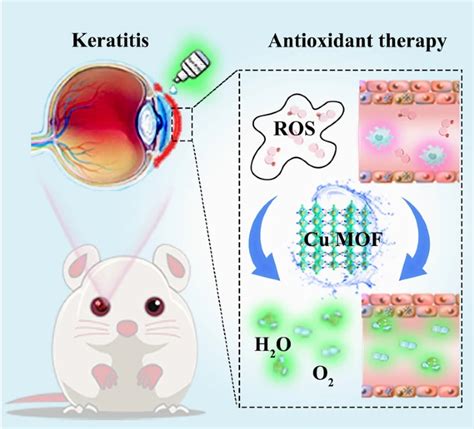 A Rational Design Of Metalorganic Framework Nanozyme With High