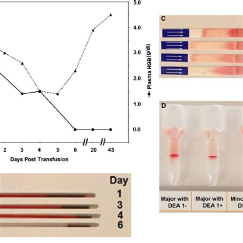 Genotype Of Human Platelet Antigen Hpa Sys Tem Of Patient And Of Download Scientific Diagram