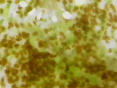 Moving Algae Under Microscope Album On Imgur
